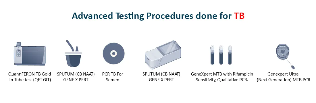 Understand Why You Need Advanced Testing Methods in TB: Get Better ...