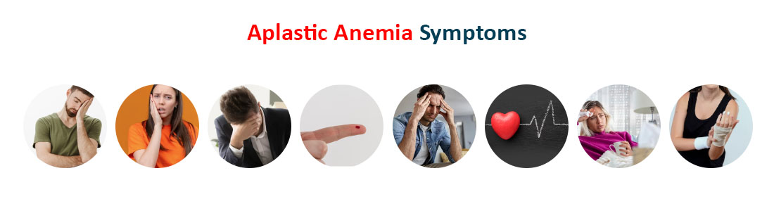 Meaning of Aplastic Anemia: Symptoms, Risk Factors, Management and ...