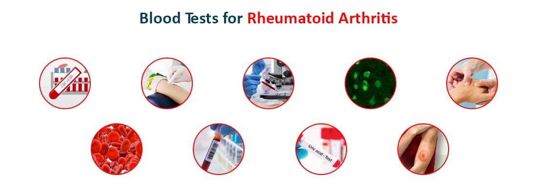 Joint Pain, Swelling and Warmth in Joints: Blood Tests To Diagnose ...