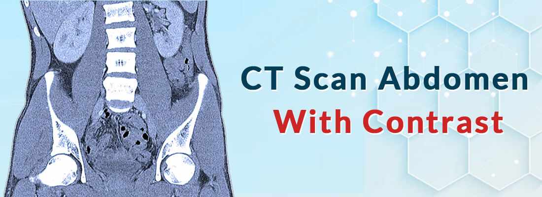 Explore the Remarkable Benefits of CT Scan In Stomach Disease | Ganesh ...