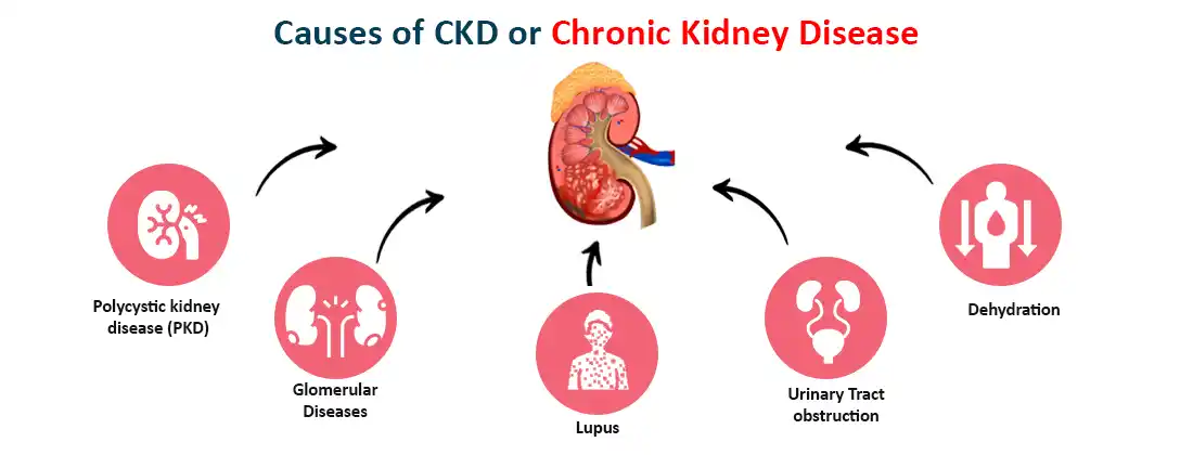 Identify Your Kidney Diseases: Causes, Symptoms, Diagnosis and ...