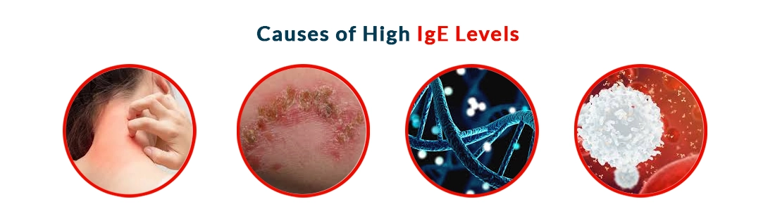 Is High IgE Level Dangerous | Ganesh Diagnostic