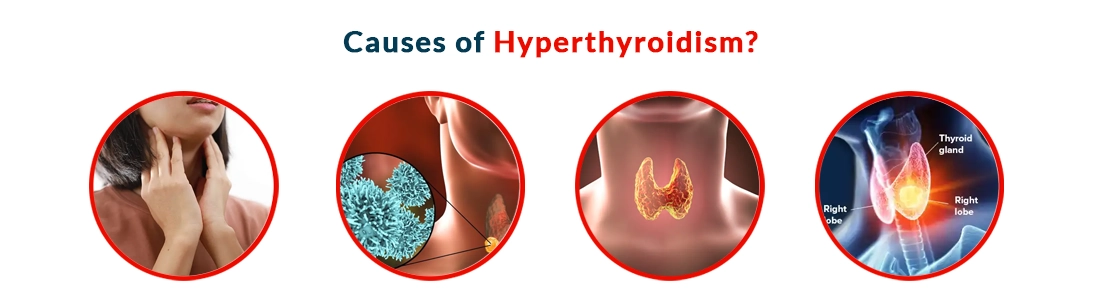 Let's discuss in this blog the disease caused due to excess thyroid ...