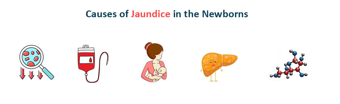 What Is Newborn Jaundice In Babies? Understand the Condition Better ...
