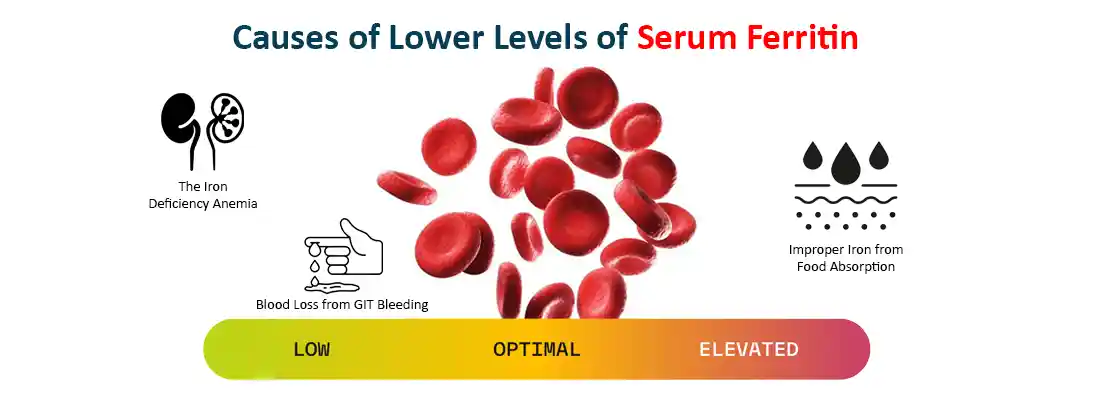 Significance Of Serum Ferritin Test : Purpose and Procedure | Ganesh ...