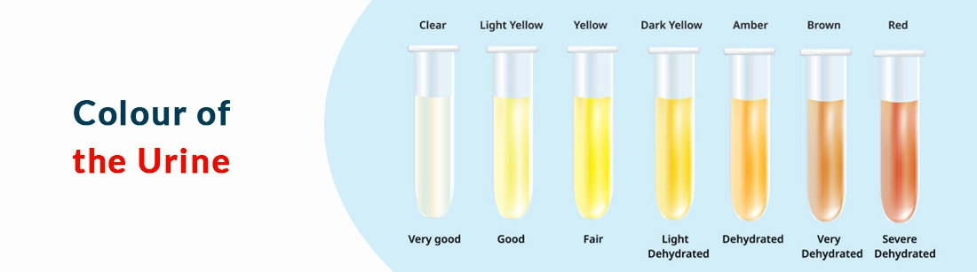 Urine Colour Chart: What's the Normal Urine Colour | Ganesh Diagnostic