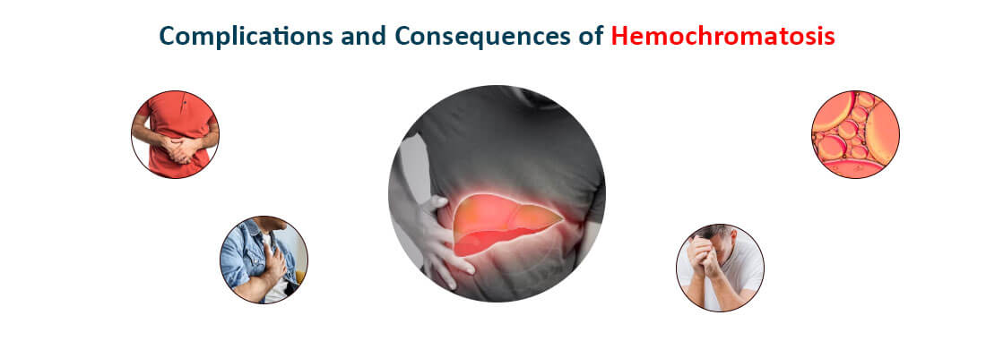 What Is Hemochromatosis? Overload Of Iron and Its Consequences | Ganesh ...