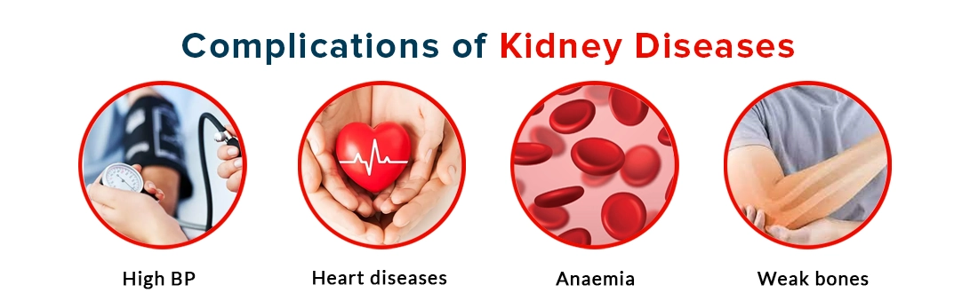 Chronic Kidney Diseases : Symptoms, Causes, Diagnosis and Treatment