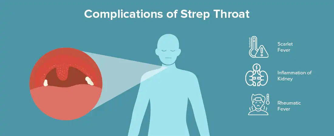 How to Identify Your Strep Throat: Seriousness and Management