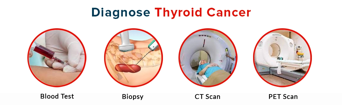 Need to Know About PET CT Scan in Diagnosing the Thyroid Cancer
