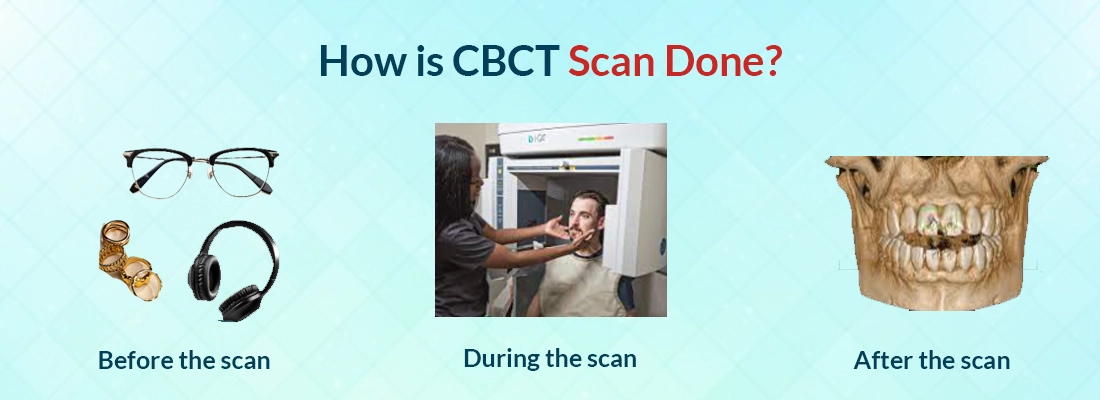 Know About CBCT Scan, A 3D Detailed View of Head and Neck