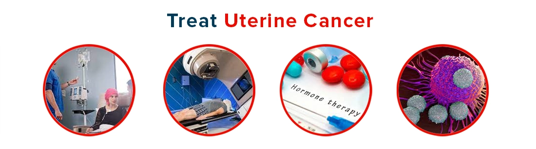 Uterine Cancer: Its Symptoms, Diagnosis and Treatment