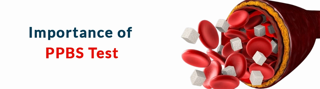 PPBS Test - Price, Procedure, Normal Range & More | Ganesh Diagnostic