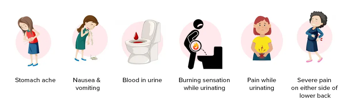 Kidney Stones - Tests and Treatment | Ganesh Diagnostic