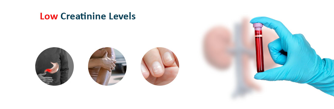 Serum Creatinine Test : Normal Level and Test Indications | Ganesh ...