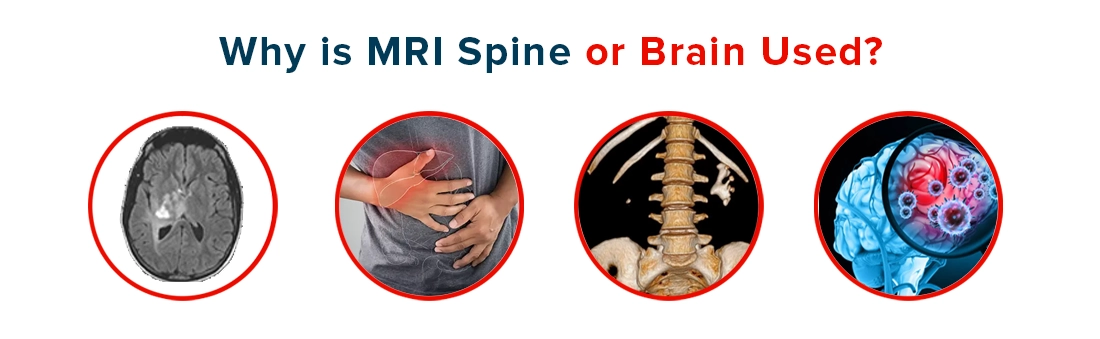 MRI Cervical Spine : Its Uses, Preparation and Possible Risks | Ganesh ...