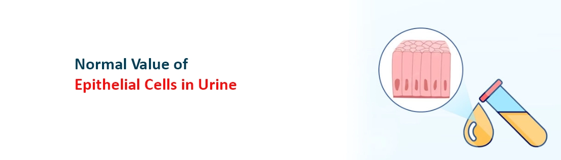 Epithelial Cells in Urine: Normal Range, What Its Results Indicate