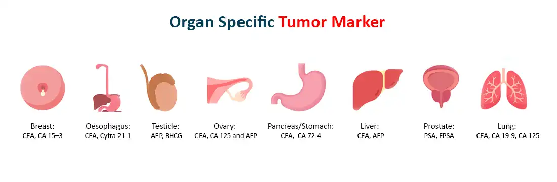 Utility Of Tumor Markers: Beat Your Tumor, Save Your Life | Ganesh ...
