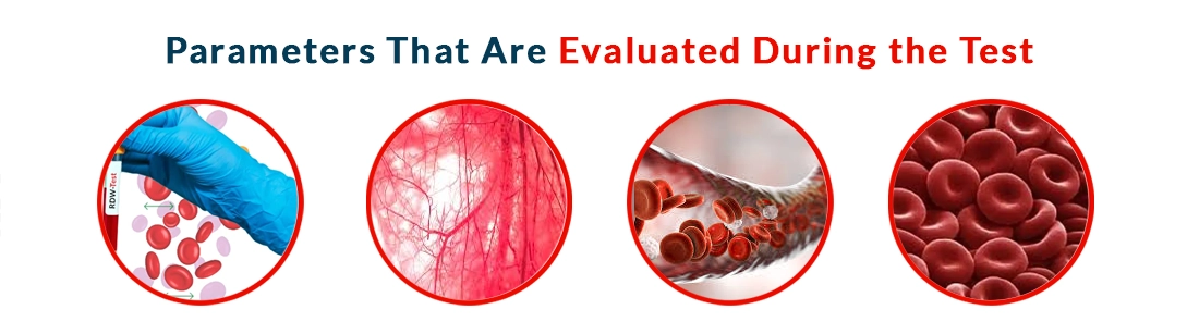 What Are MCH Levels?- Evaluation, Normal Range and Results