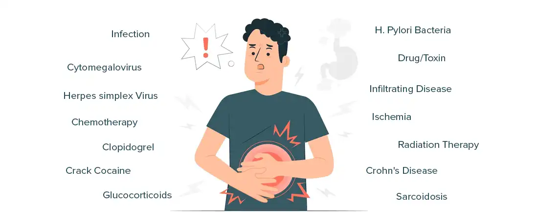 A Complete Guide on Peptic Ulcer Disease | Ganesh Diagnostic