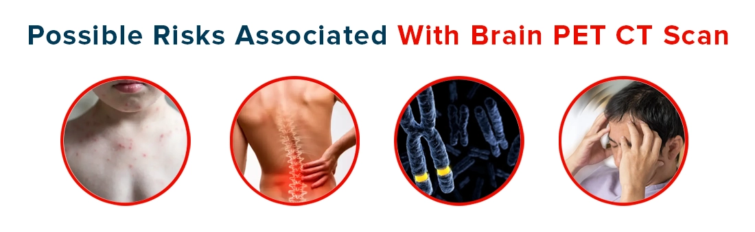 Brain PET CT Scan | Its Uses, Procedure and Risks