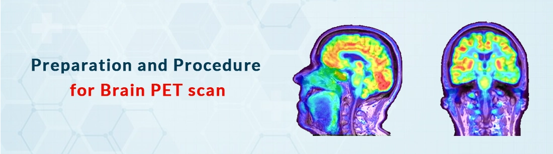 Brain PET Scan: Procedure, Requirement and Precautions