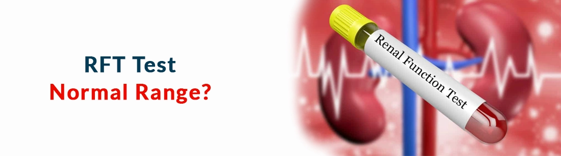 RFT Test - Price, Purpose, Procedure, and Results | Common Questions ...