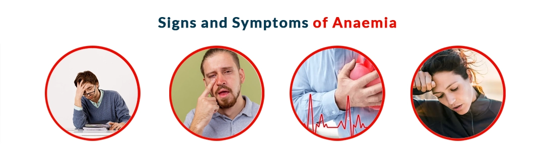 Anaemia: Symptoms, Causes, Diagnosis, Treatment and Prevention