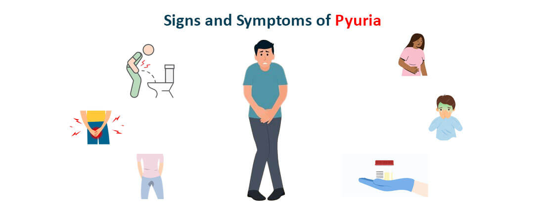 Meaning of Urine Microscopy Pus Cells: Symptoms, Normal Range ...