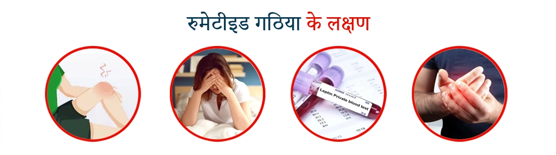 RA Factor परीक्षण: क्या है, कैसे, और क्यों किया जाता है?