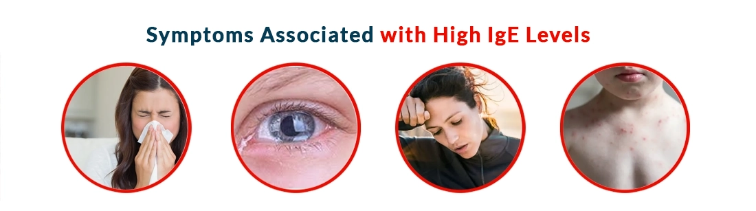 Is High IgE Level Dangerous | Ganesh Diagnostic