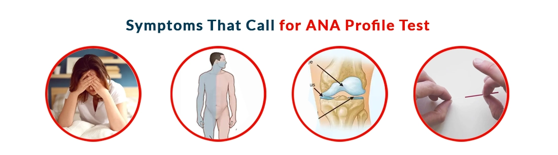 ANA Profile Test - Preparation, Procedure, Cost and Disease