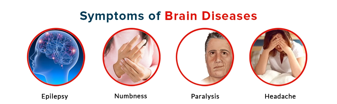 Brain Diseases, Its Types, Causes, Symptoms and Diagnosis