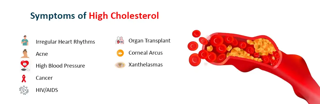 High Cholesterol Level: How to Make Healthy Lifestyle Choices | Ganesh ...