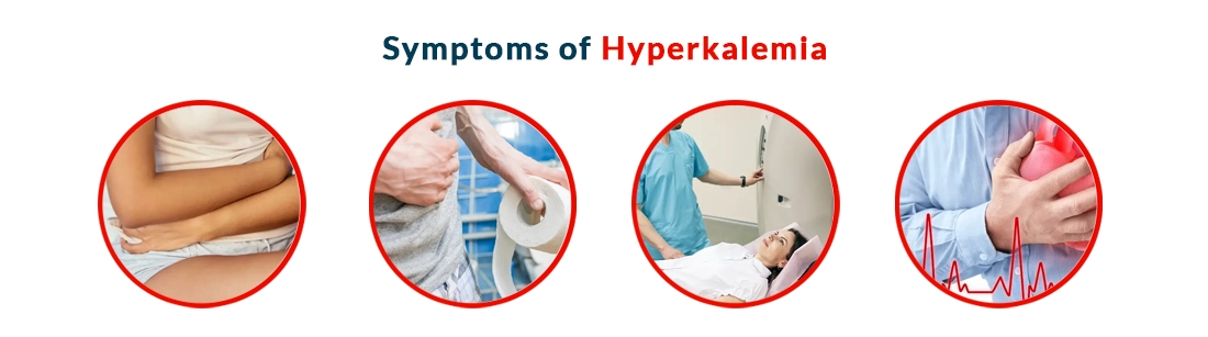 Hyperkalemia: Causes, Symptoms, Diagnosis, Management and Treatment
