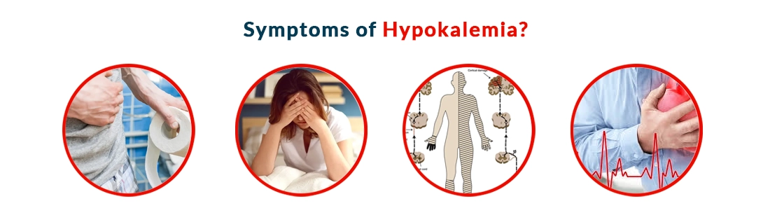 Hypokalemia: Causes, Symptoms, Diagnosis, Management and Treatment