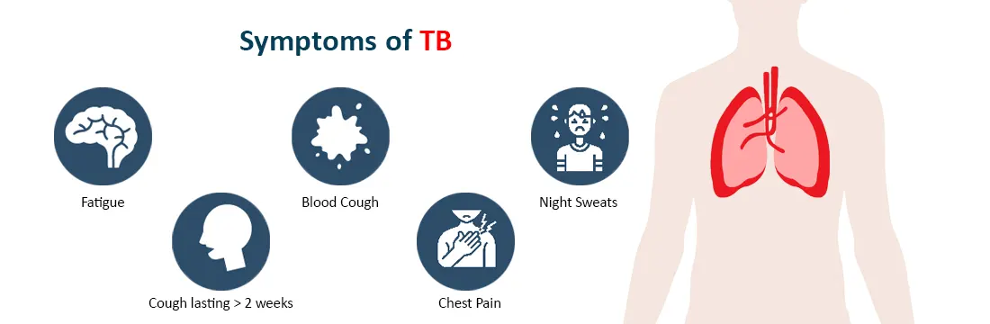 Understand Why You Need Advanced Testing Methods in TB: Get Better ...