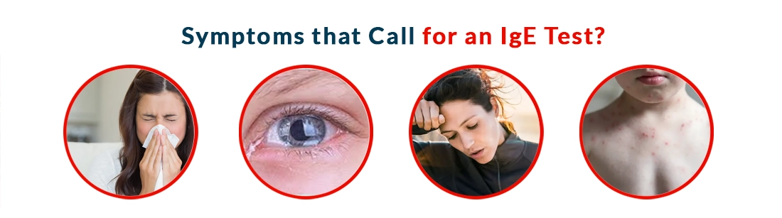 Total IgE Test : Price, Preparation, Procedure, Normal Range