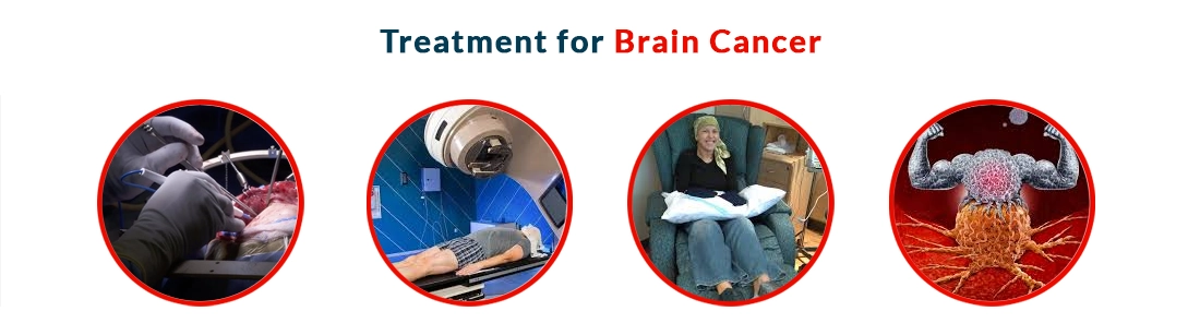 Brain Cancer: Causes, Types, Diagnosis, Treatment, Prevention and Cost