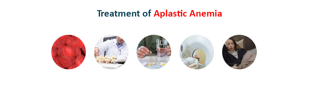 Meaning of Aplastic Anemia: Symptoms, Risk Factors, Management and ...