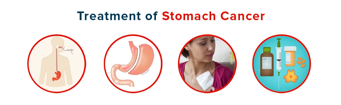 Facts and Diagnosis of Stomach Cancer | Causes, Symptoms of Stomach Cancer