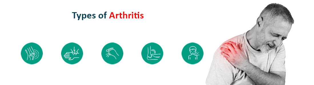 Recognize Types of Arthritis: Symptoms, Causes and Management ...