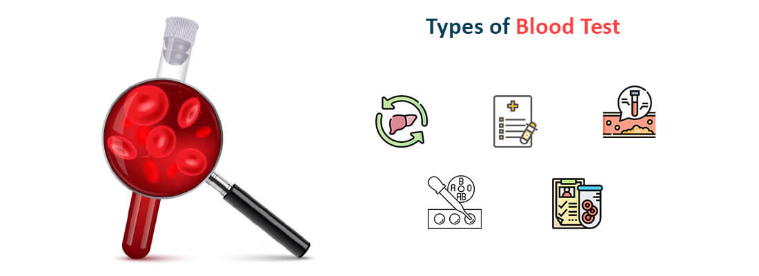 Blood Tests For Kids: Care For Your Children To Test and Treat Early ...