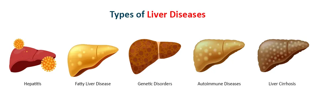 Liver Diseases: Unleash the Ability to Regenerate | Ganesh Diagnostic