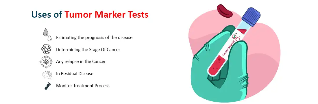 Utility Of Tumor Markers: Beat Your Tumor, Save Your Life | Ganesh ...