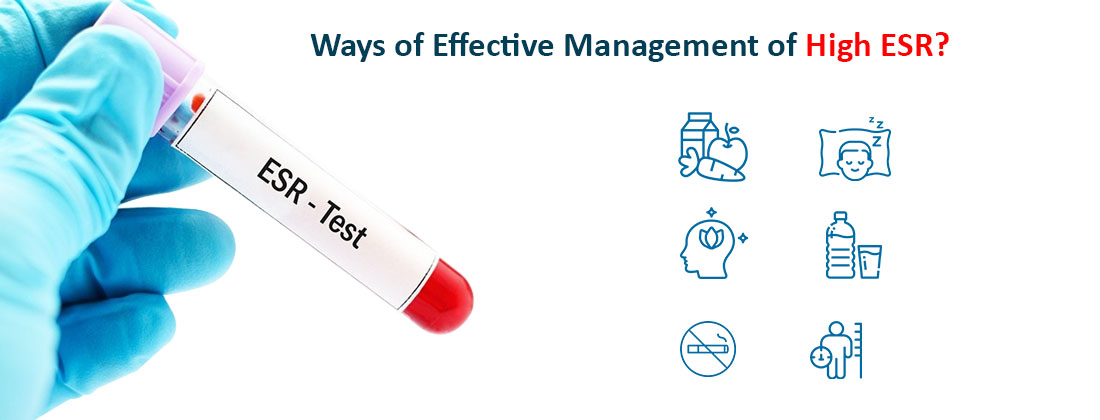 High ESR Levels: Symptoms and Natural Ways to Reduce Easily | Ganesh ...