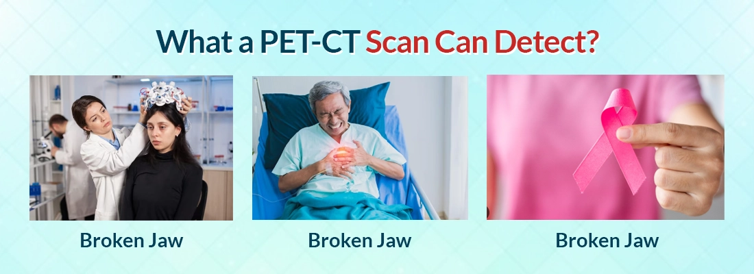 PET CT Scan a Diagnostic Tool, and All About It | Ganesh Diagnostic