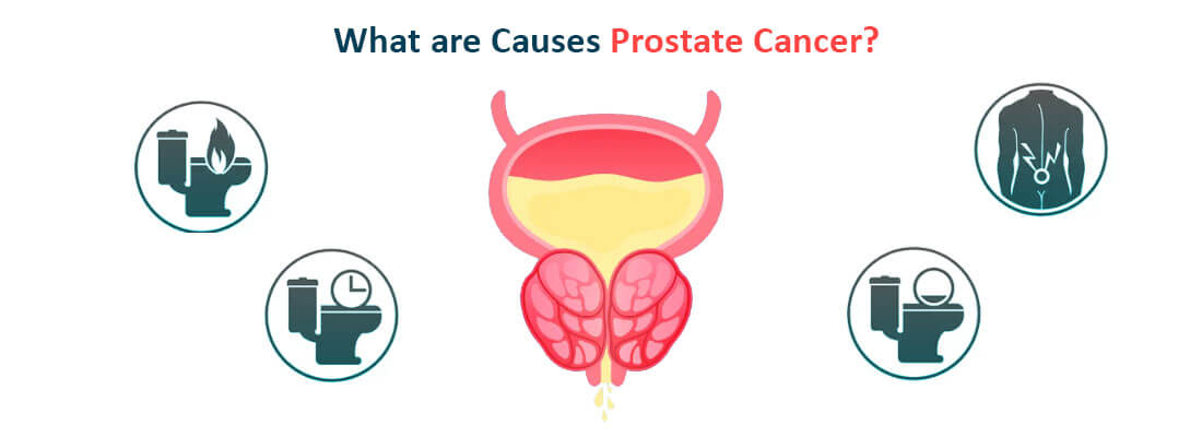 Detect Prostrate Cancer Early? Importance of Screening and Blood Tests ...