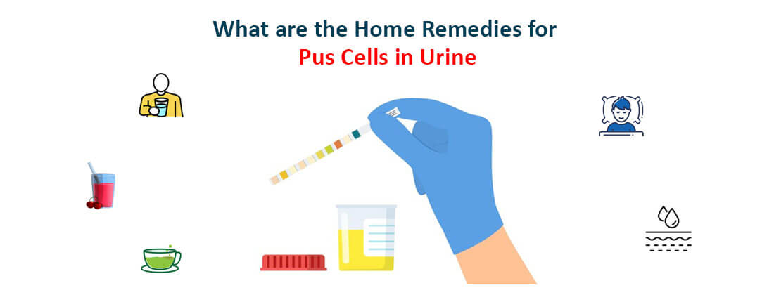 Meaning of Urine Microscopy Pus Cells: Symptoms, Normal Range ...