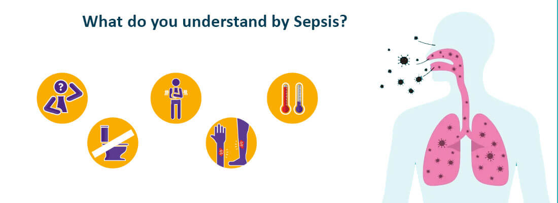 High Procalcitonin: How Does It Help Diagnose Your Sepsis | Ganesh ...